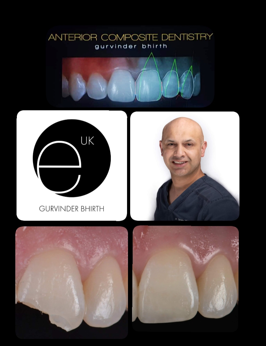 DR. GURVINDER BHIRTH | 004 JAN 25 | NEO Smile